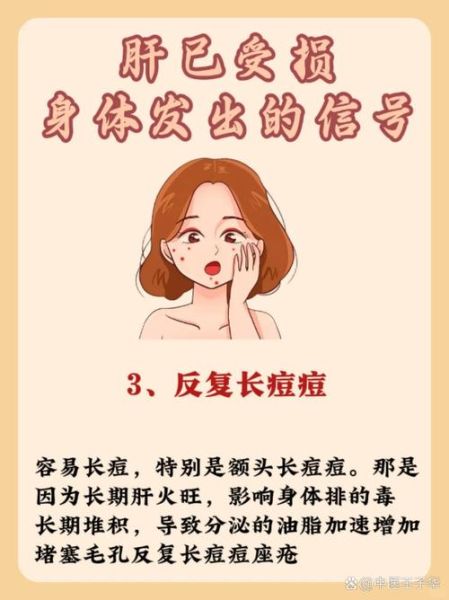 肝不好有什么症状_肝不好的早期表现有哪些-第2张图片-山城妙识 肝不好有什么症状_肝不好的早期表现有哪些-第2张图片-山城妙识