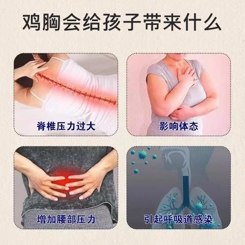 鸡胸怎么矫正_鸡胸矫正方法有哪些-第1张图片-山城妙识