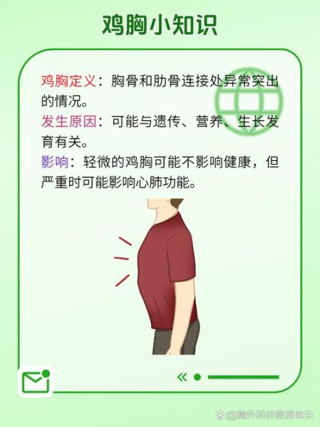 鸡胸怎么矫正_鸡胸矫正方法有哪些-第3张图片-山城妙识