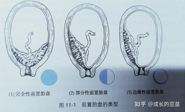 胎盘图片怎么看_胎盘结构图解-第1张图片-山城妙识 胎盘图片怎么看_胎盘结构图解-第1张图片-山城妙识