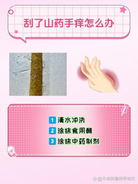 切完山药手痒怎么办_快速止痒小妙招-第3张图片-山城妙识