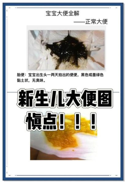 果酱样大便是什么颜色_果酱样大便颜色正常吗-第1张图片-山城妙识