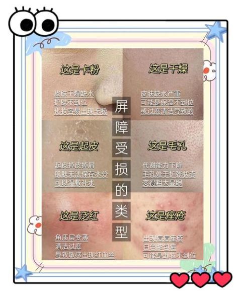 皮肤干燥脱屑像雪花怎么办_为什么皮肤会起皮屑-第1张图片-山城妙识 皮肤干燥脱屑像雪花怎么办_为什么皮肤会起皮屑-第1张图片-山城妙识