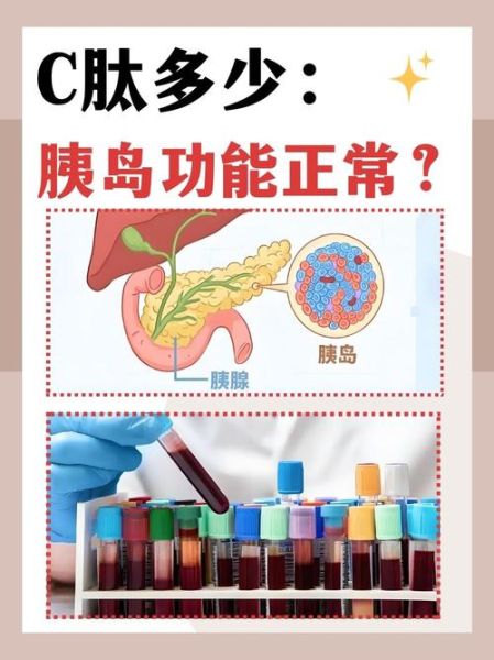 恢复胰岛功能吃什么最好_哪些食物能修复胰岛β细胞-第2张图片-山城妙识