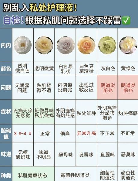 豆腐渣样白带是什么原因_豆腐渣样白带怎么办-第2张图片-山城妙识 豆腐渣样白带是什么原因_豆腐渣样白带怎么办-第2张图片-山城妙识