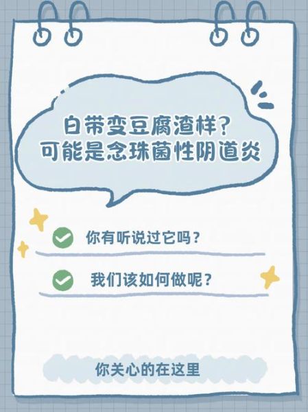 豆腐渣样白带是什么原因_豆腐渣样白带怎么办-第3张图片-山城妙识 豆腐渣样白带是什么原因_豆腐渣样白带怎么办-第3张图片-山城妙识