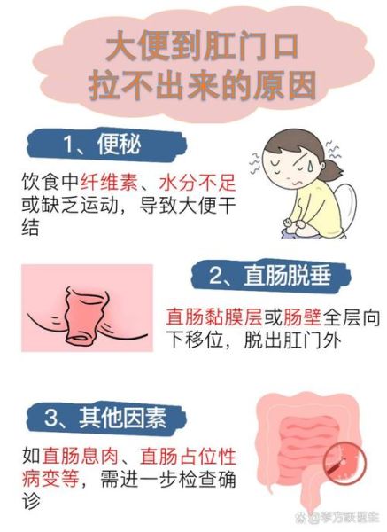 大便干结已到肛门拉不出来怎么办_肛门堵塞紧急处理-第2张图片-山城妙识