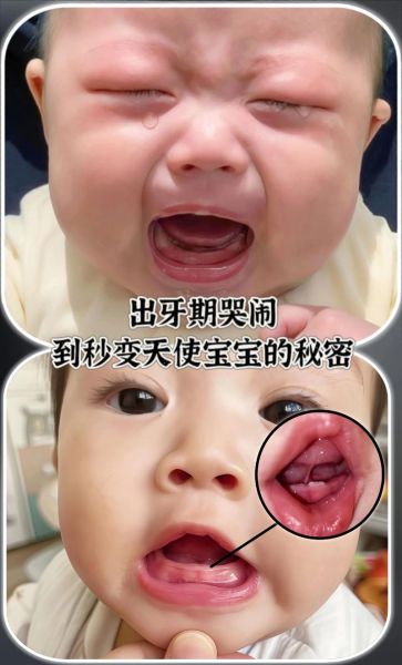 磨牙饼干有什么危害_宝宝吃磨牙饼干安全吗-第1张图片-山城妙识 磨牙饼干有什么危害_宝宝吃磨牙饼干安全吗-第1张图片-山城妙识