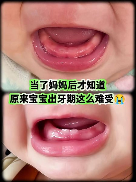 磨牙饼干有什么危害_宝宝吃磨牙饼干安全吗-第3张图片-山城妙识 磨牙饼干有什么危害_宝宝吃磨牙饼干安全吗-第3张图片-山城妙识
