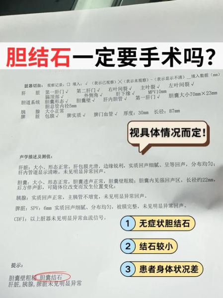 胆结石多大需要手术_必须切除吗-第1张图片-山城妙识