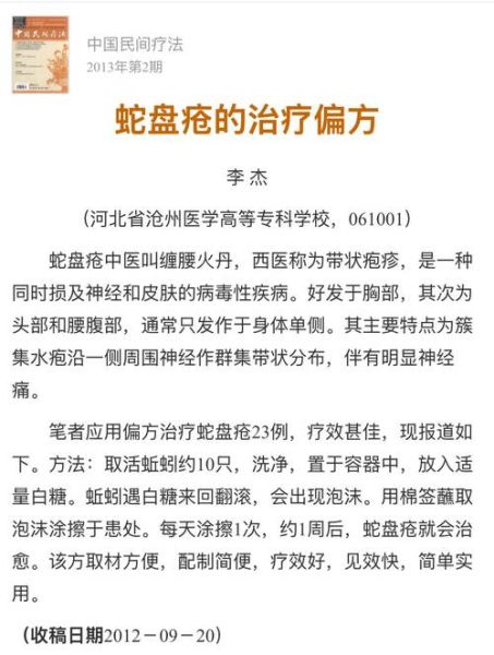 治蛇缠腰的草药克星_民间偏方真的有用吗-第3张图片-山城妙识 治蛇缠腰的草药克星_民间偏方真的有用吗-第3张图片-山城妙识