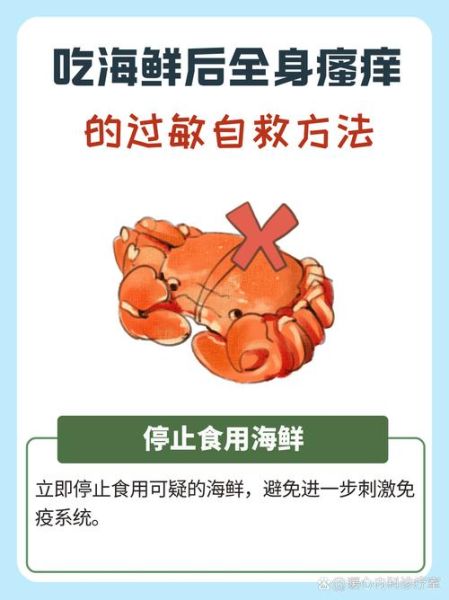 吃海鲜过敏怎么办_快速止痒小妙招-第1张图片-山城妙识