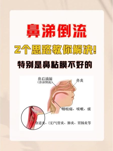 如何快速止鼻涕_止鼻涕的小妙招有哪些-第3张图片-山城妙识 如何快速止鼻涕_止鼻涕的小妙招有哪些-第3张图片-山城妙识