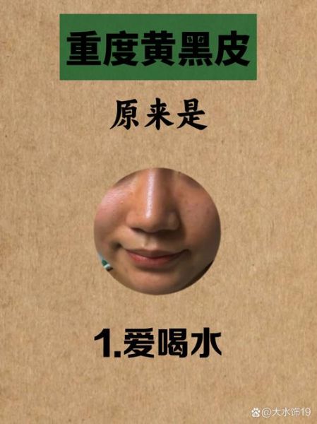 祛斑排行榜第一名是哪个_效果真的好吗-第2张图片-山城妙识 祛斑排行榜第一名是哪个_效果真的好吗-第2张图片-山城妙识