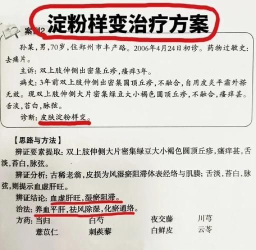 淀粉样变皮肤病偏方_淀粉样变皮肤病民间疗法-第1张图片-山城妙识 淀粉样变皮肤病偏方_淀粉样变皮肤病民间疗法-第1张图片-山城妙识