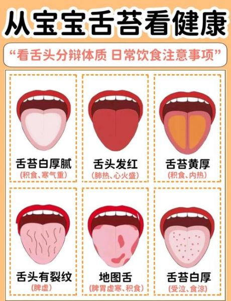 草莓舌是什么原因造成的_怎么判断是不是猩红热-第3张图片-山城妙识