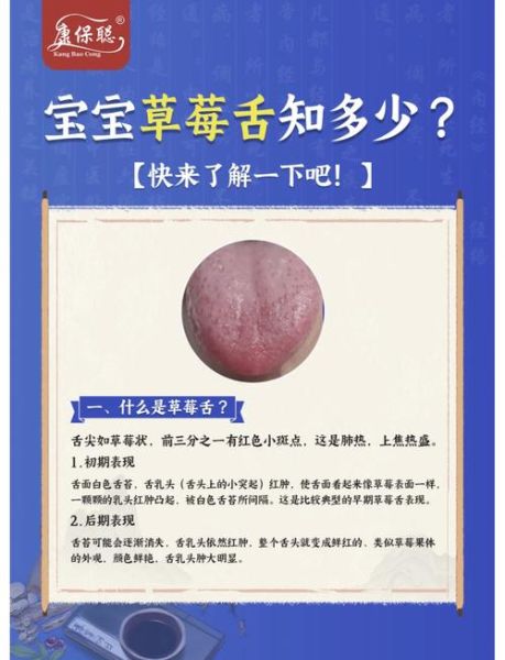 草莓舌是什么原因造成的_怎么判断是不是猩红热-第1张图片-山城妙识