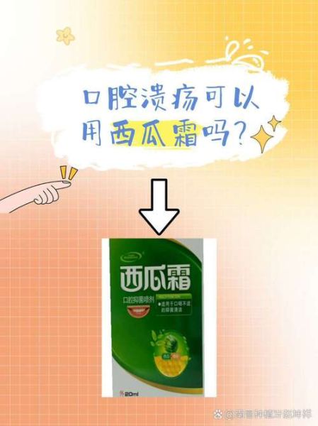 西瓜霜能治口腔溃疡吗_西瓜霜喷剂怎么用-第2张图片-山城妙识