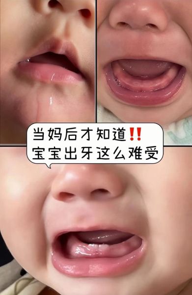 磨牙棒有什么危害_磨牙棒会导致牙齿变形吗-第3张图片-山城妙识 磨牙棒有什么危害_磨牙棒会导致牙齿变形吗-第3张图片-山城妙识