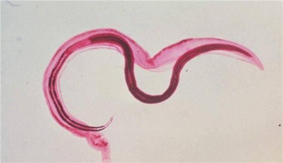 血吸虫图片_血吸虫长什么样-第3张图片-山城妙识