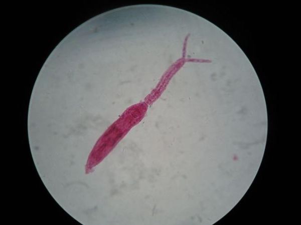 血吸虫图片_血吸虫长什么样-第1张图片-山城妙识