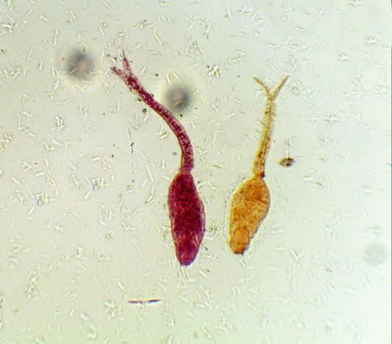 血吸虫图片_血吸虫长什么样-第2张图片-山城妙识