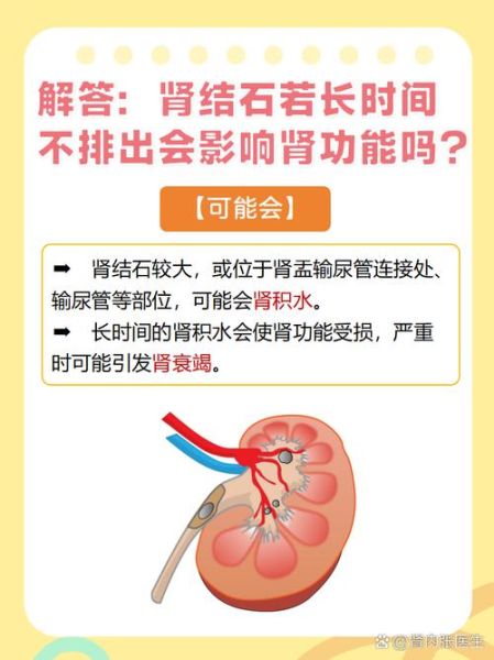 肾结石能根治吗_肾结石会影响寿命吗-第1张图片-山城妙识 肾结石能根治吗_肾结石会影响寿命吗-第1张图片-山城妙识