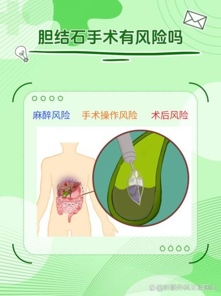 胆结石多大必须做手术_手术指征详解-第1张图片-山城妙识 胆结石多大必须做手术_手术指征详解-第1张图片-山城妙识