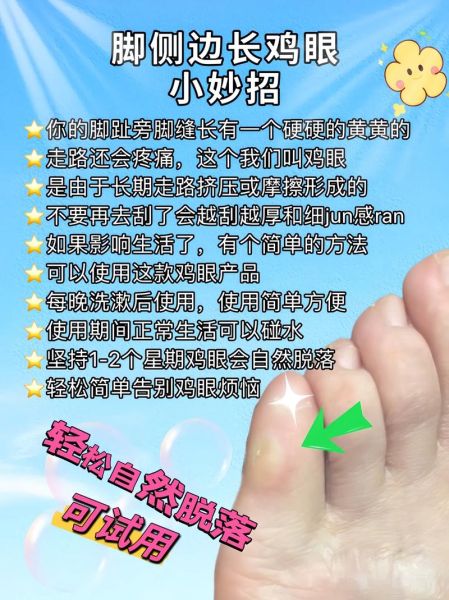 鸡眼是怎么形成的_鸡眼是什么原因引起的-第1张图片-山城妙识