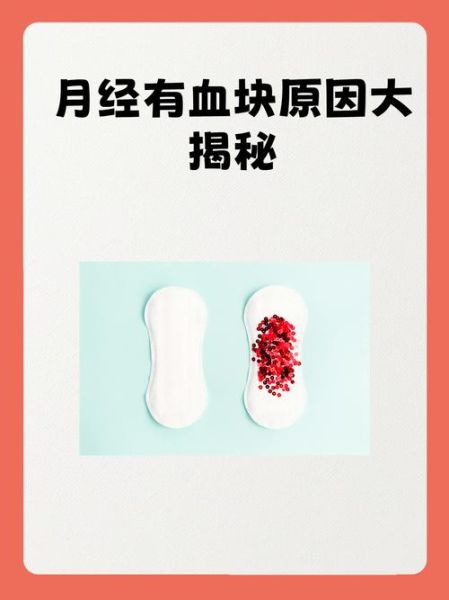 月经排出一大坨果冻血块正常吗_月经血块像果冻一样怎么回事-第2张图片-山城妙识