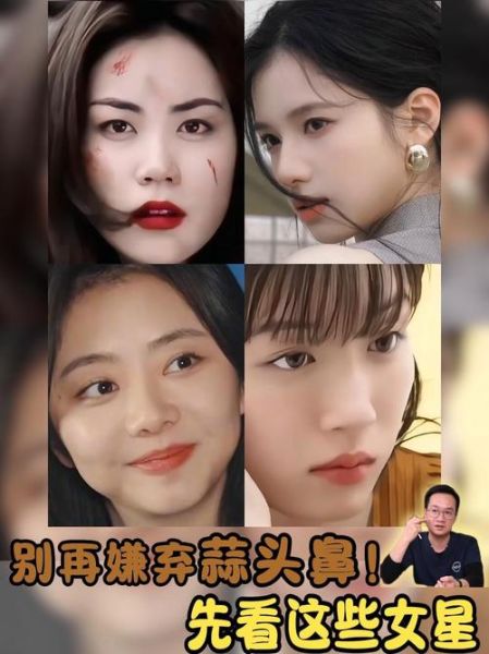 蒜头鼻面相好不好_蒜头鼻女人旺夫吗-第1张图片-山城妙识