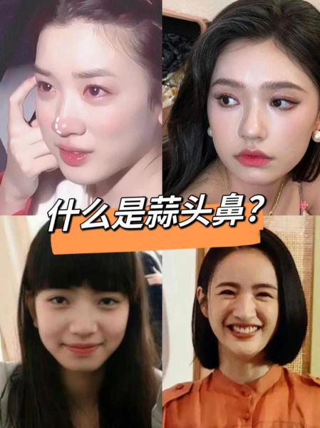 蒜头鼻面相好不好_蒜头鼻女人旺夫吗-第3张图片-山城妙识