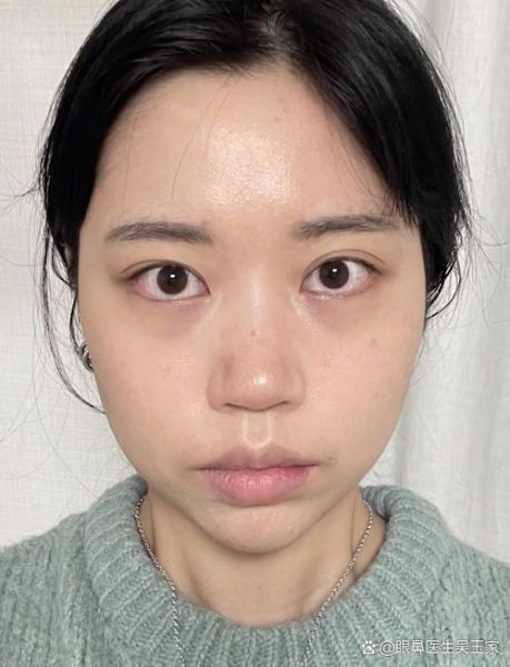 蒜头鼻面相好不好_蒜头鼻女人旺夫吗-第2张图片-山城妙识