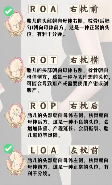 平躺姿势看男女_如何辨别胎儿性别-第1张图片-山城妙识