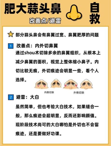 蒜头鼻长什么样_蒜头鼻怎么改善-第3张图片-山城妙识 蒜头鼻长什么样_蒜头鼻怎么改善-第3张图片-山城妙识