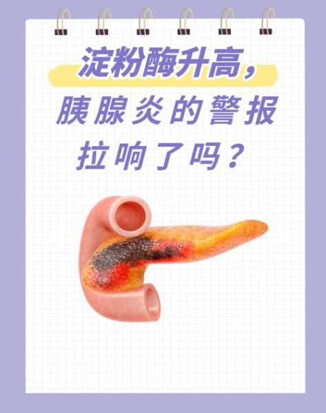 淀粉酶升高是什么病_淀粉酶升高怎么办-第1张图片-山城妙识