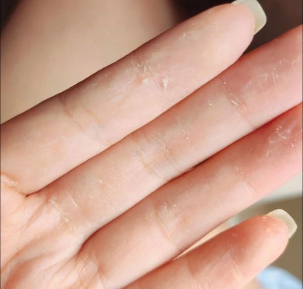 佛手瓜要削皮吗_佛手瓜皮能吃吗-第2张图片-山城妙识