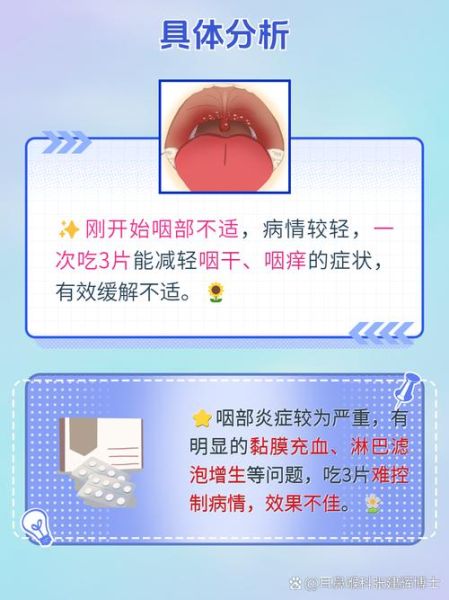 喉咙痛去药店买什么药_喉咙痛吃什么药好得快-第1张图片-山城妙识