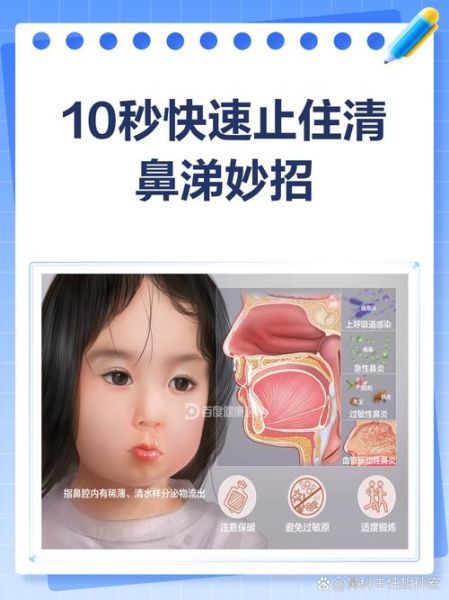 如何立刻止住流清水鼻涕_流清水鼻涕怎么办-第1张图片-山城妙识