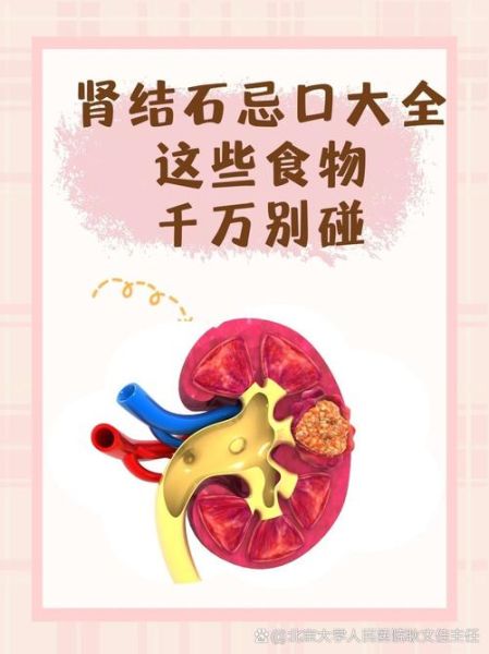 肾结石不能吃什么_肾结石吃什么好-第3张图片-山城妙识