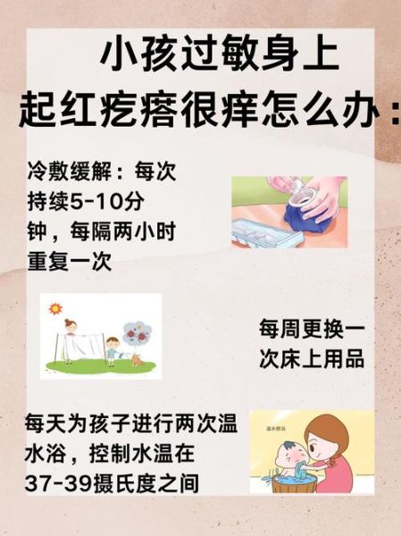 宝宝过敏起红疙瘩怎么办_宝宝过敏红疙瘩怎么快速止痒-第2张图片-山城妙识 宝宝过敏起红疙瘩怎么办_宝宝过敏红疙瘩怎么快速止痒-第2张图片-山城妙识