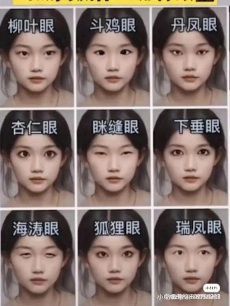 腰果眼图片_腰果眼是什么病-第1张图片-山城妙识