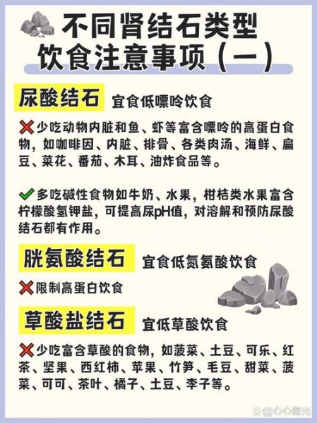 肾结石不能吃什么_肾结石饮食禁忌有哪些-第1张图片-山城妙识