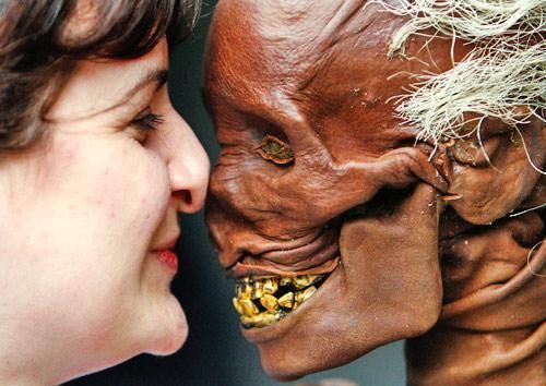 蜗牛人是什么_蜗牛人症状表现-第2张图片-山城妙识