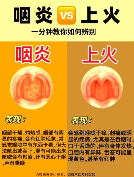 咽喉炎和咽喉癌最明显的区别_如何判断-第1张图片-山城妙识