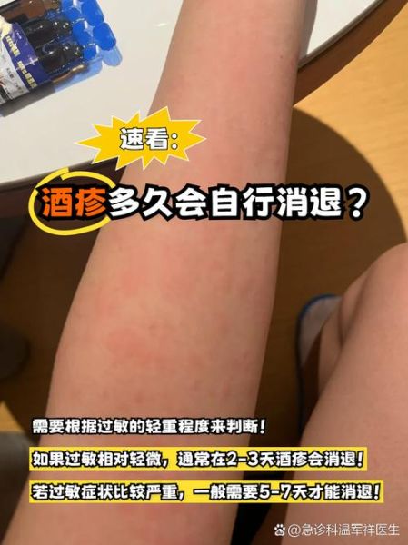 过敏多久会自行消退_过敏症状几天能好-第2张图片-山城妙识