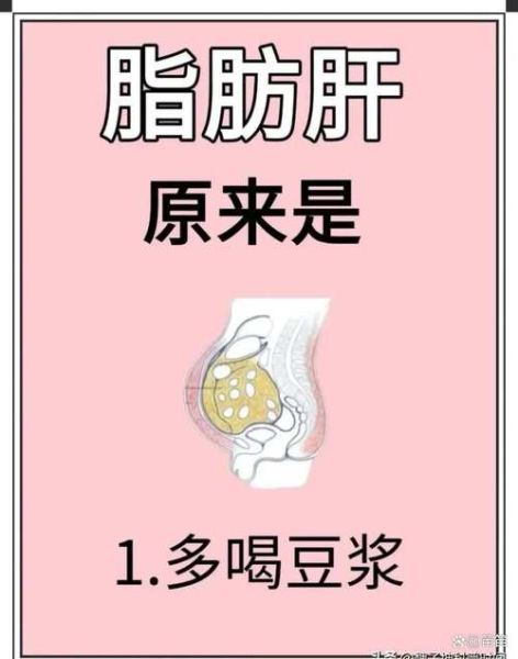 如何消除肝上的脂肪_脂肪肝怎么调理-第1张图片-山城妙识