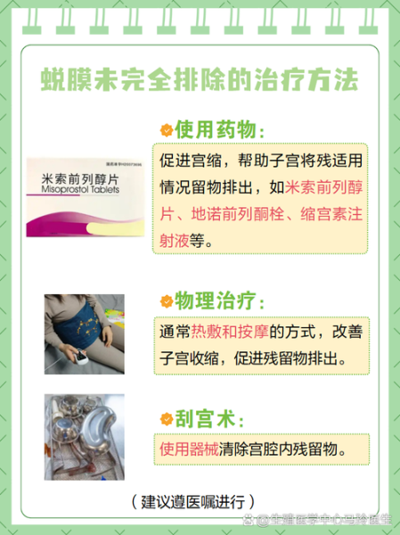 早孕流产症状_如何判断是否流产-第3张图片-山城妙识