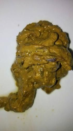 肠癌大便图片_肠癌早期大便特征-第2张图片-山城妙识