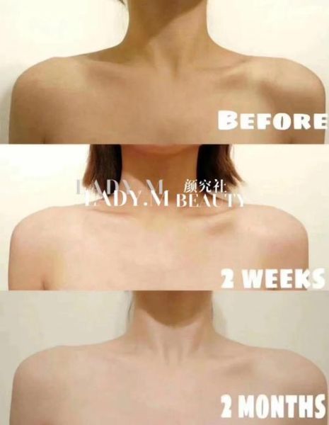 美白偏方快速见效_真的有用吗-第1张图片-山城妙识